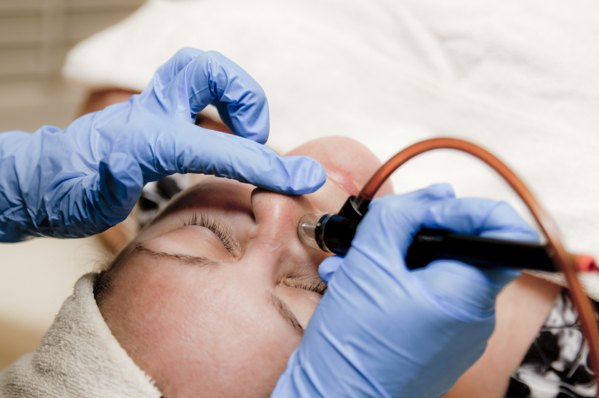 Acne Treatments | Benson Dermatology